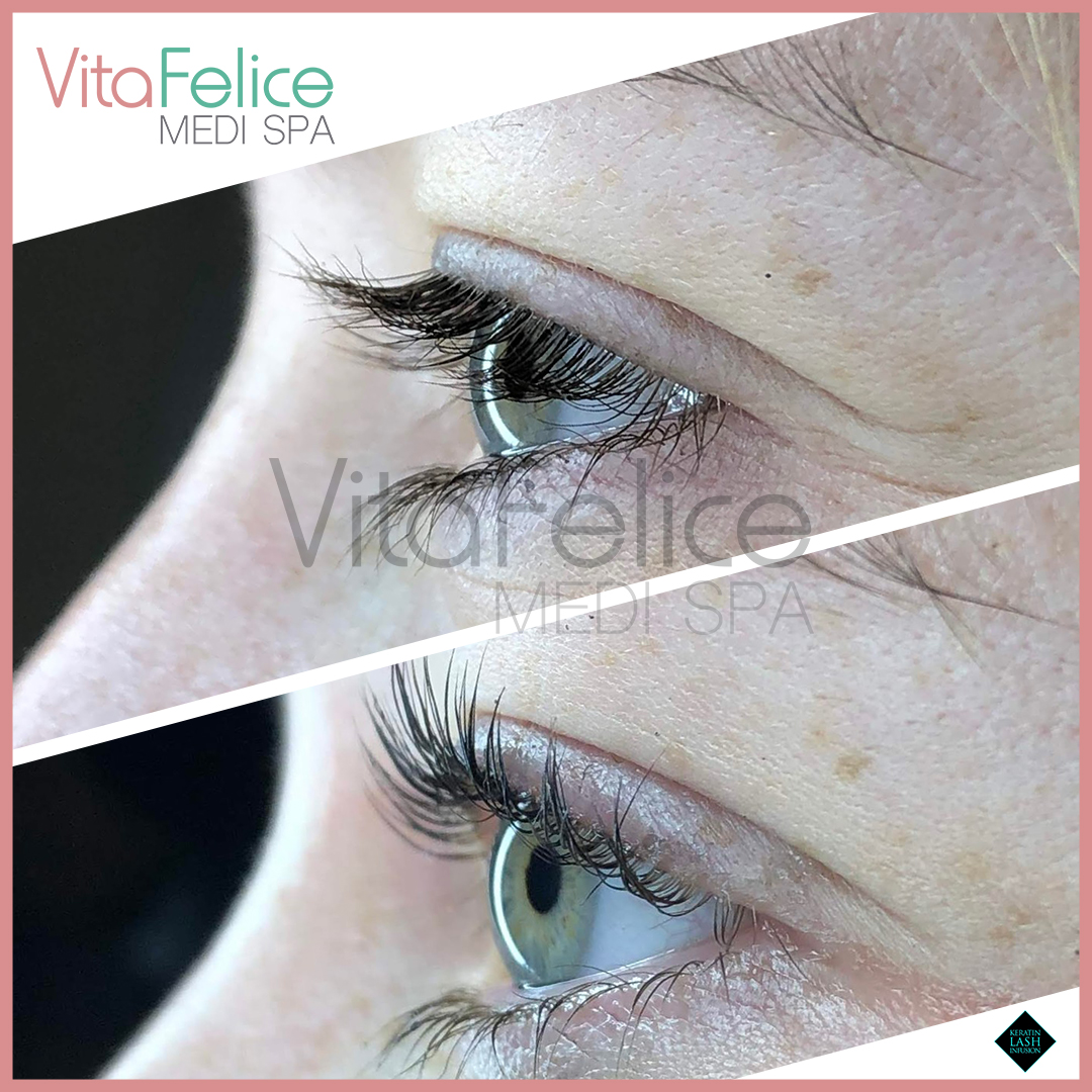 Keratin Lash Lift & Tint in New Westminster | Vita Felice