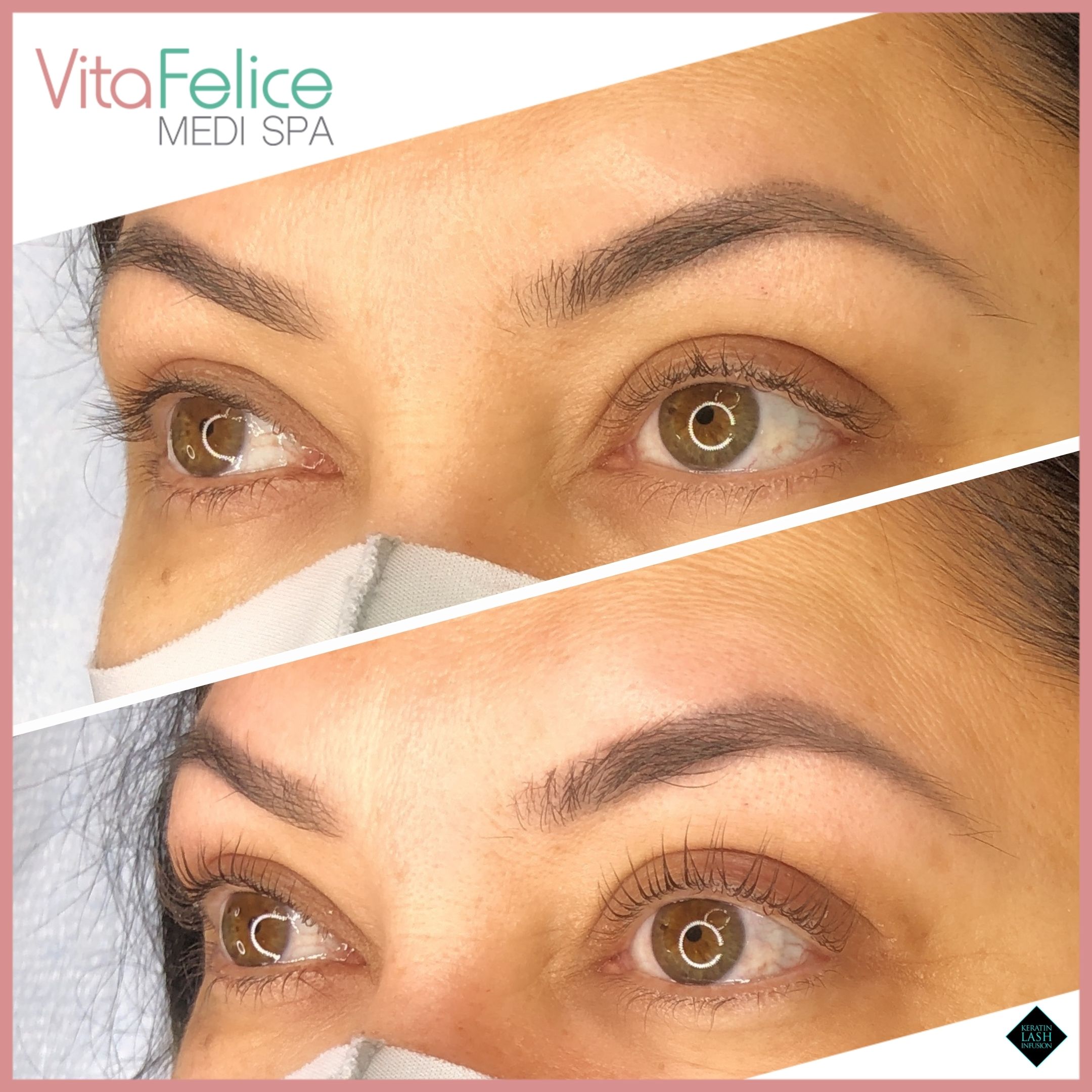 LASH LIFT AND TINT – Vita Felice Medi Spa